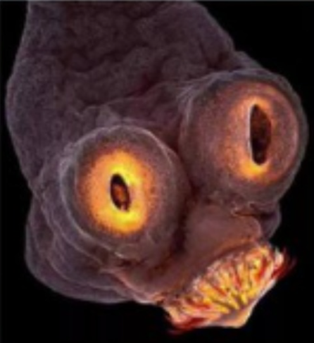 Doctors Find a Dead Worm in RJK Jr’s Brain – Remi Tribe